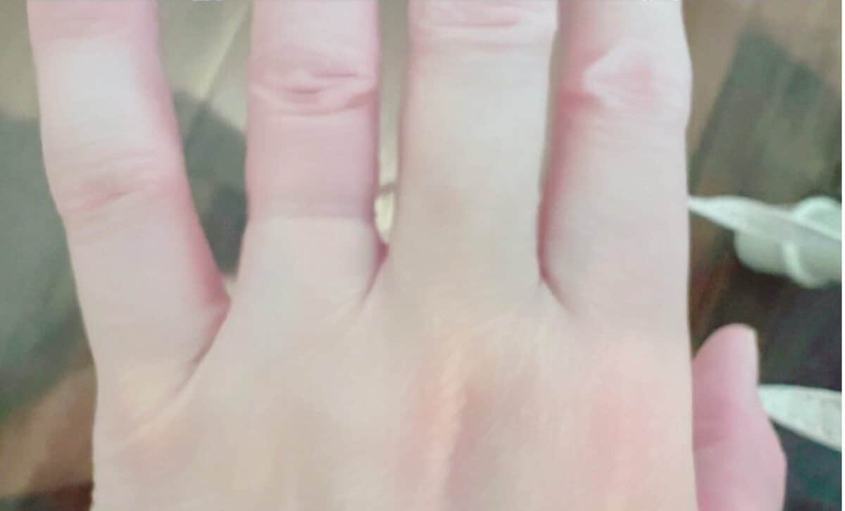 私の入院が足の不自由な息子の自立のチャンスに 障害児を育てる親が入院。そのとき家族は？ Aera